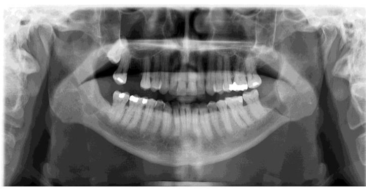 Facial Trauma Charlestown NSW, Facial Injuries